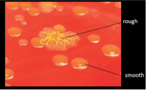 Pneumococcus Colonies